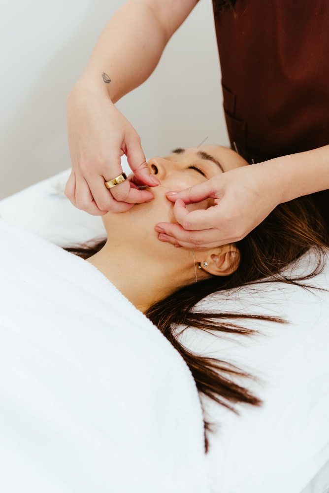 My Acupuncture Gallery – Finesse Photography